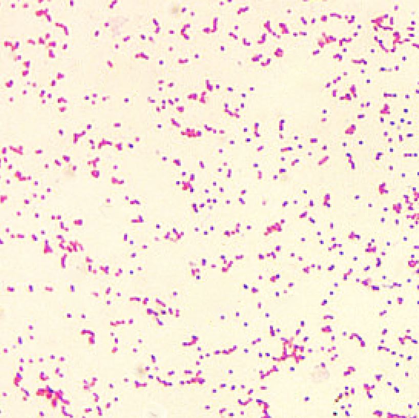 Brucellosis - MD Searchlight