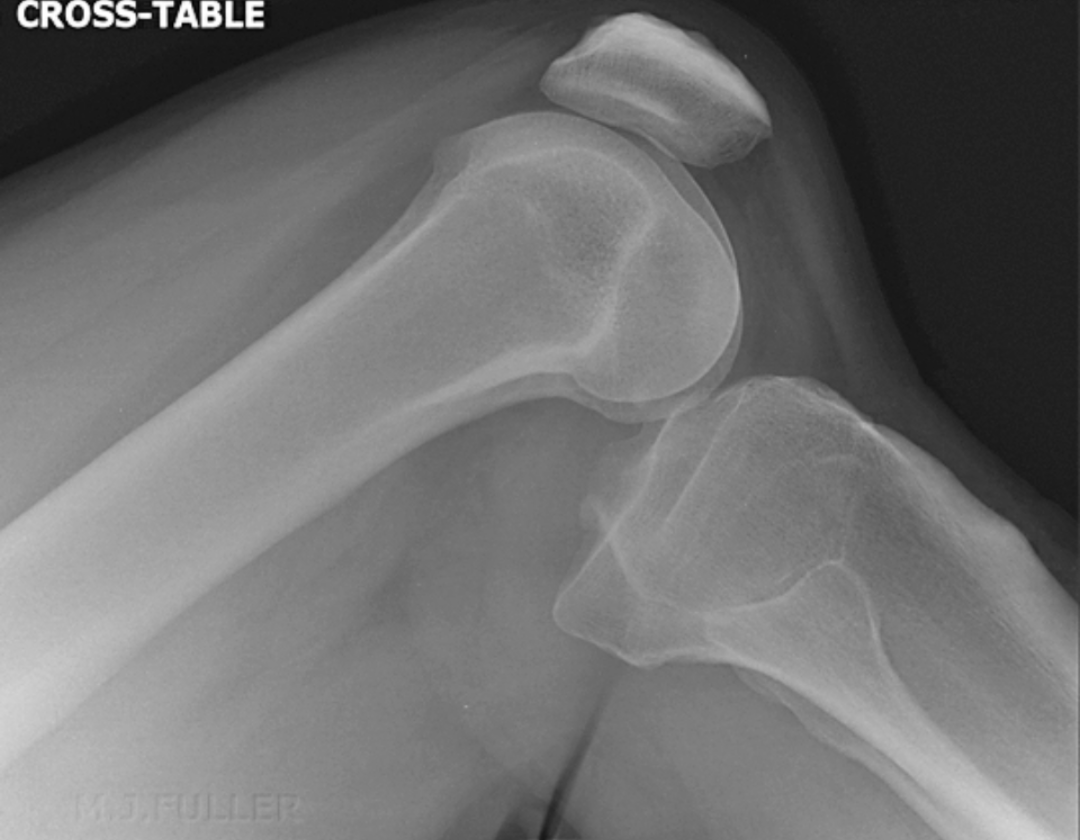 Knee Dislocation - MD Searchlight