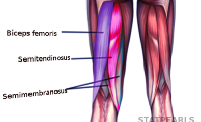 Hamstring Injury - MD Searchlight