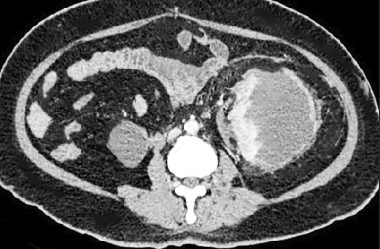 Page Kidney - MD Searchlight