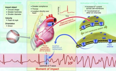 Cardiac Trauma (Hits to the Chest and Heart) - MD Searchlight