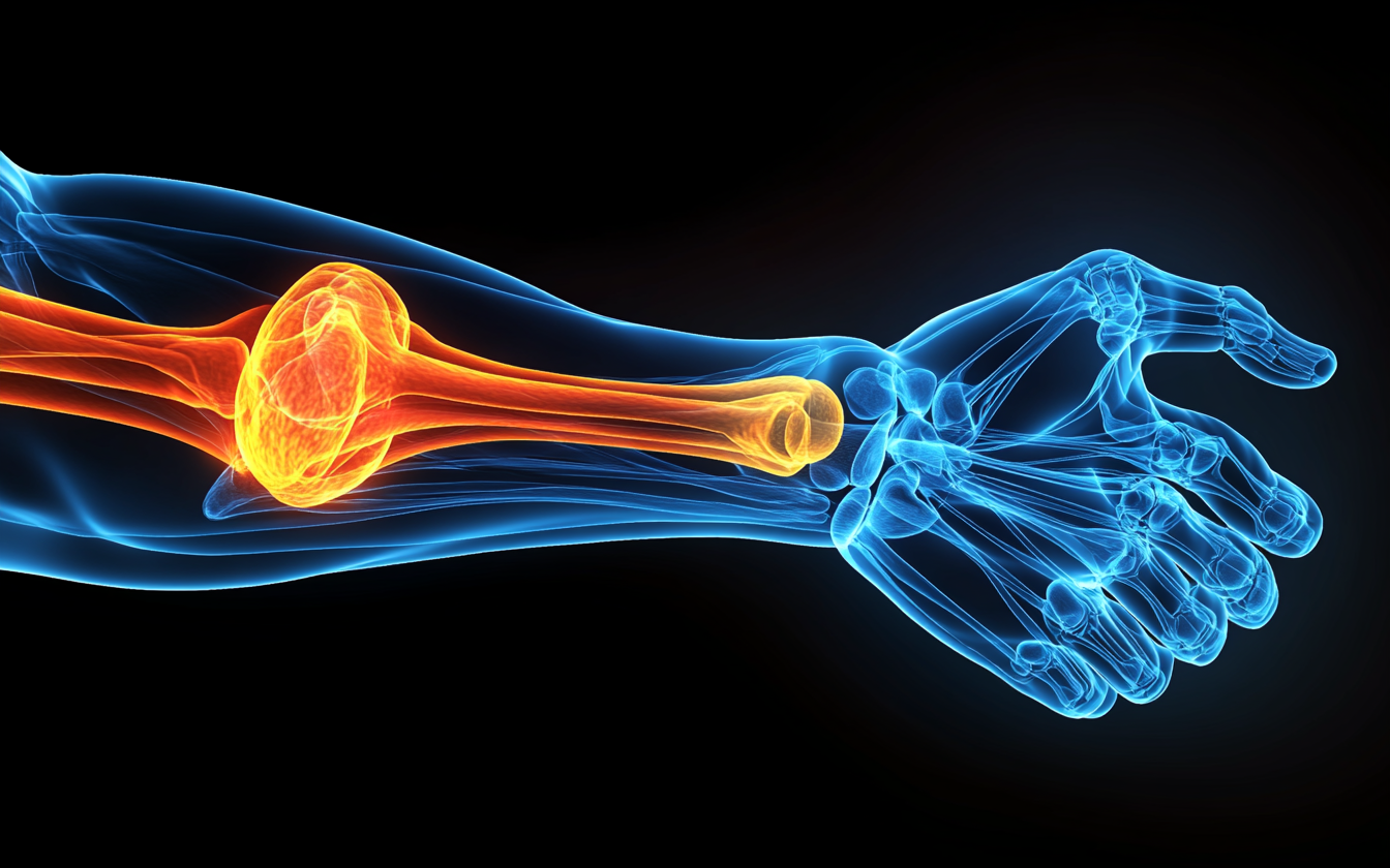 Radial Nerve Entrapment - MD Searchlight