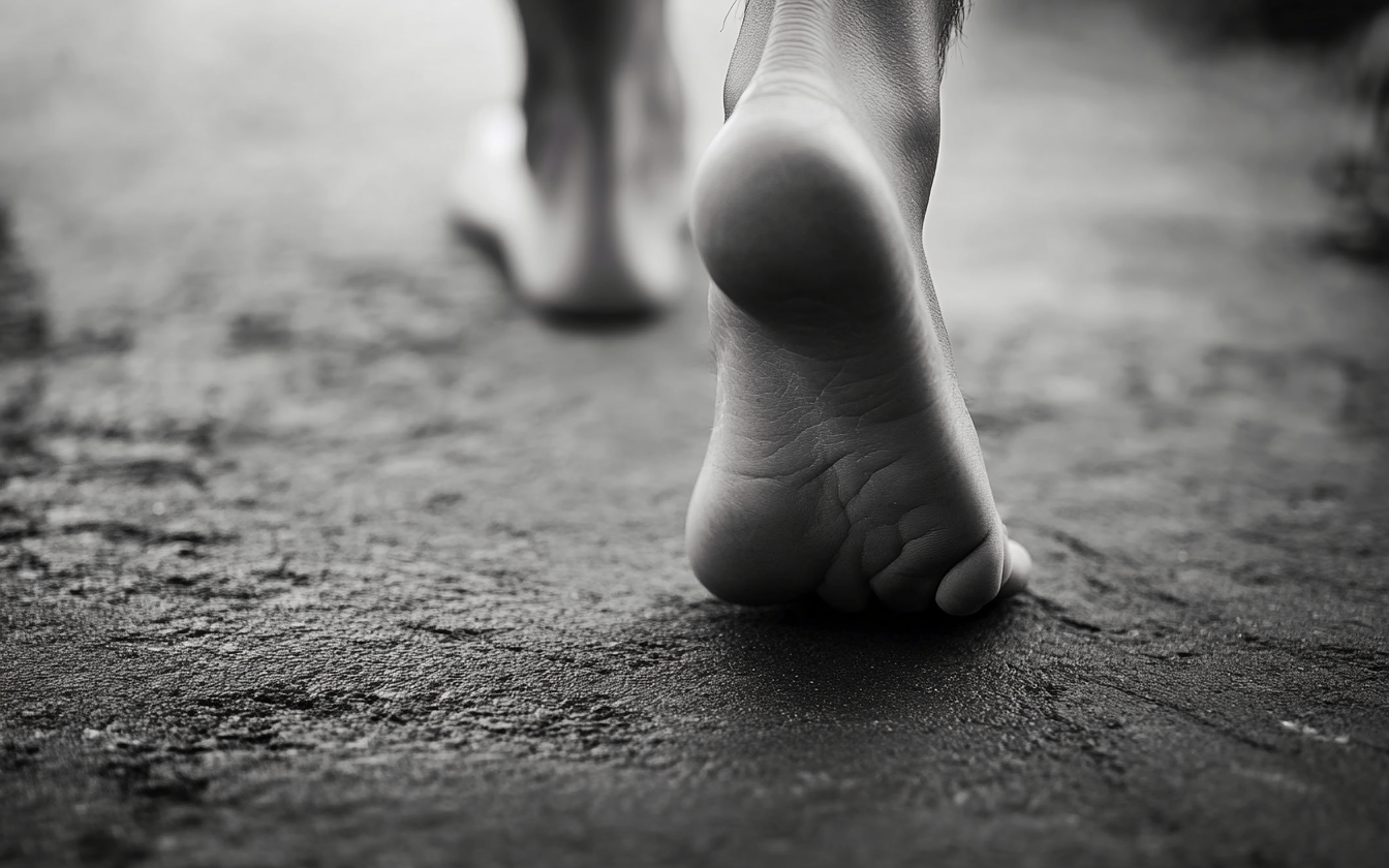 Acrokeratosis Verruciformis of Hopf - MD Searchlight