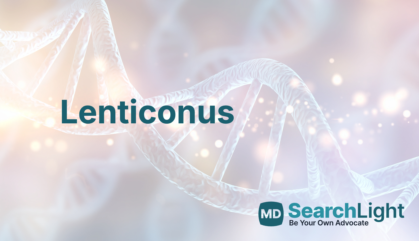 Lenticonus - MD Searchlight