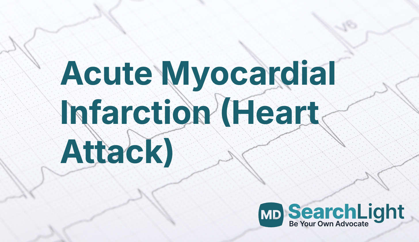 Acute Myocardial Infarction (Heart Attack) - MD Searchlight