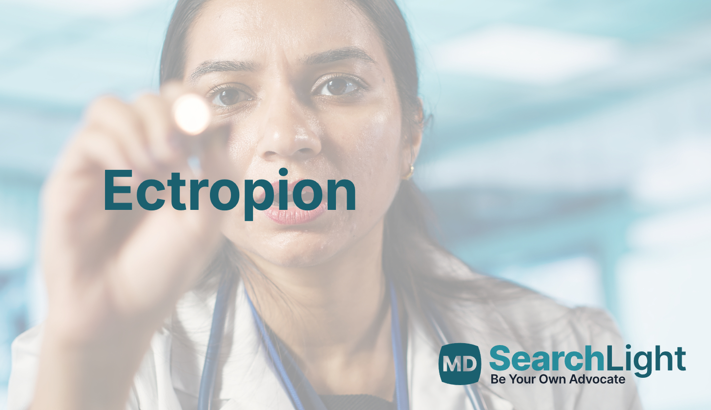 Ectropion - MD Searchlight