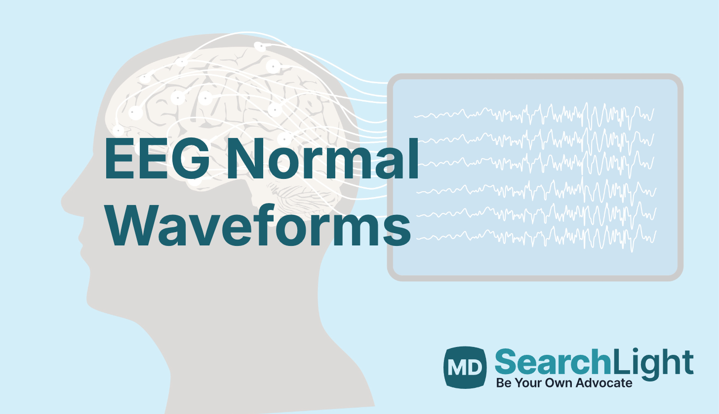 EEG Normal Waveforms (Electroencephalography (EEG)) - MD Searchlight