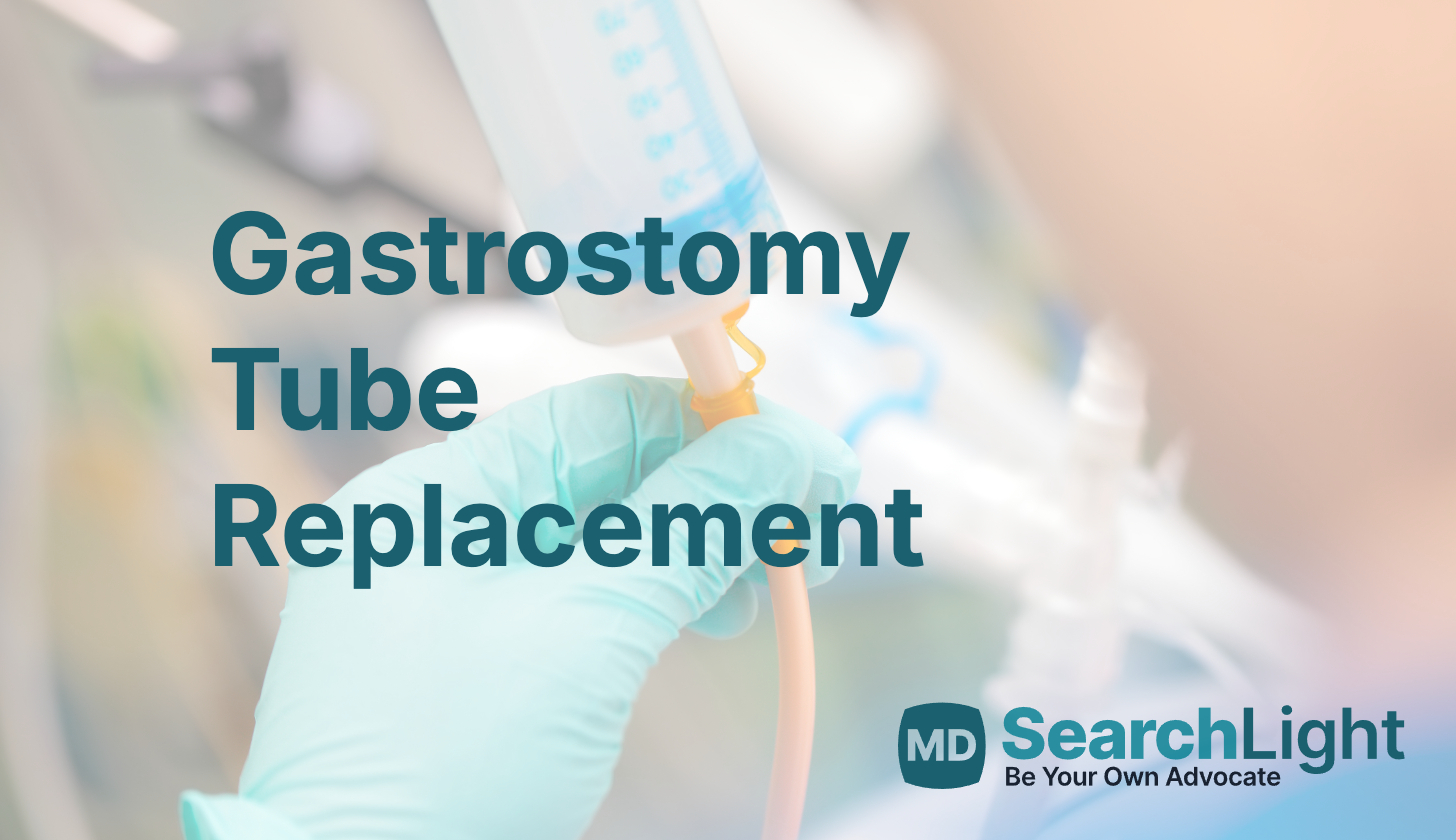 Gastrostomy Tube Replacement (G-Tube Replacement) - MD Searchlight