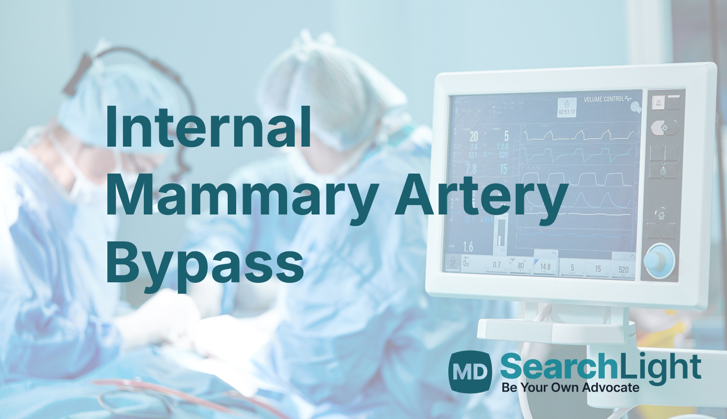 Internal Mammary Artery Bypass - MD Searchlight