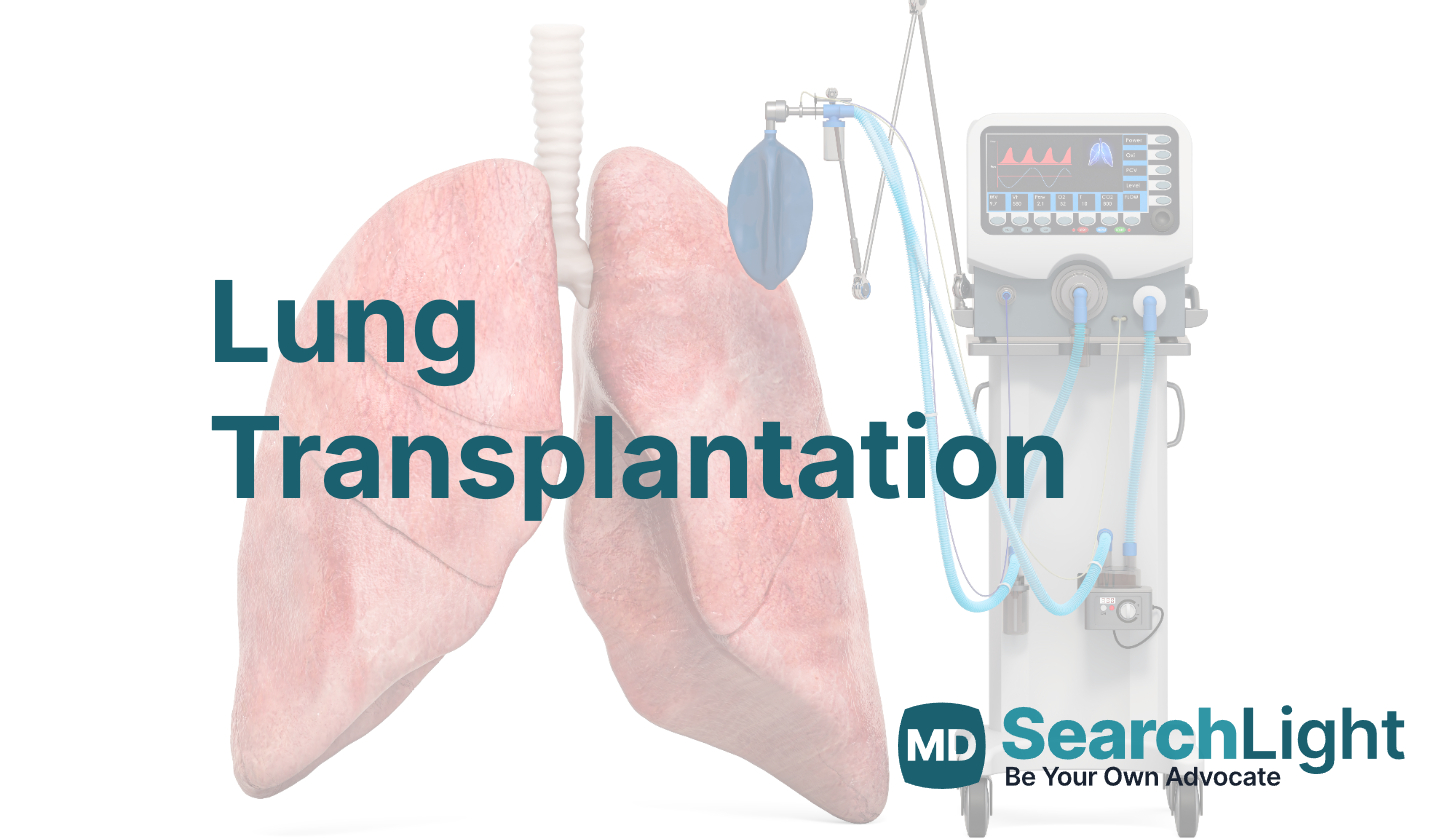 Lung Transplantation (Lung Transplant) - MD Searchlight