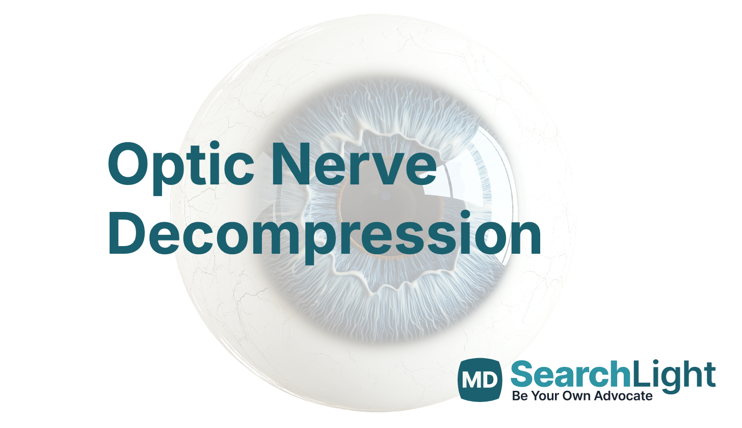 Optic Nerve Decompression - MD Searchlight