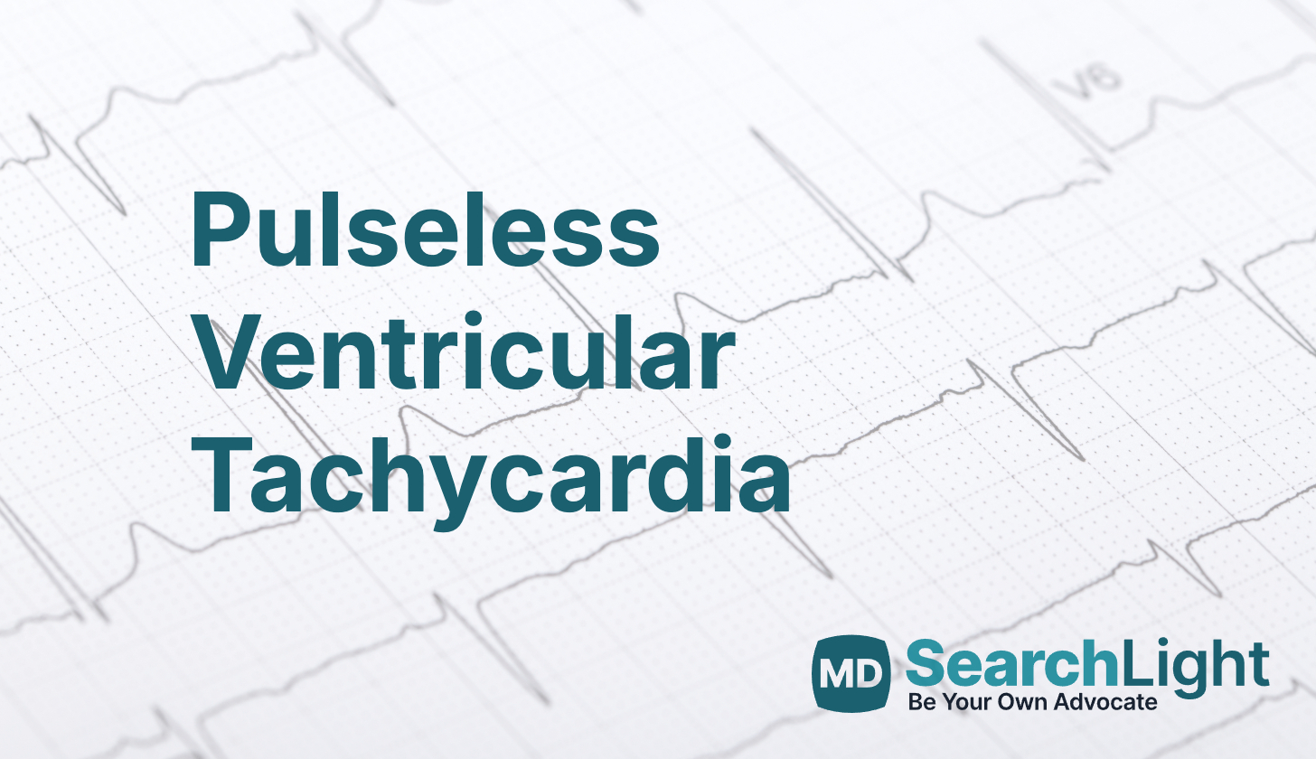 Pulseless Ventricular Tachycardia - MD Searchlight