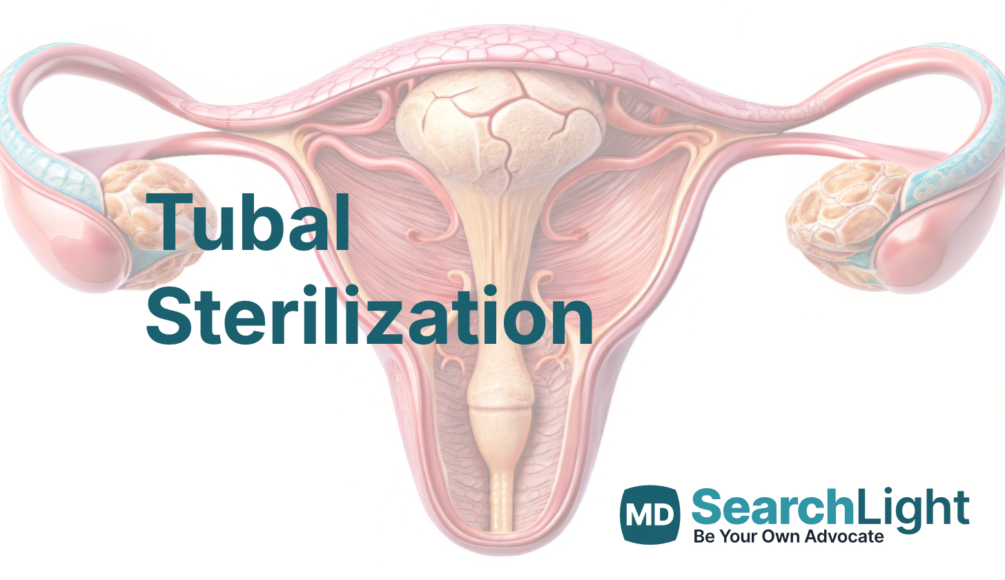 Tubal Sterilization (Tubal Ligation) - MD Searchlight