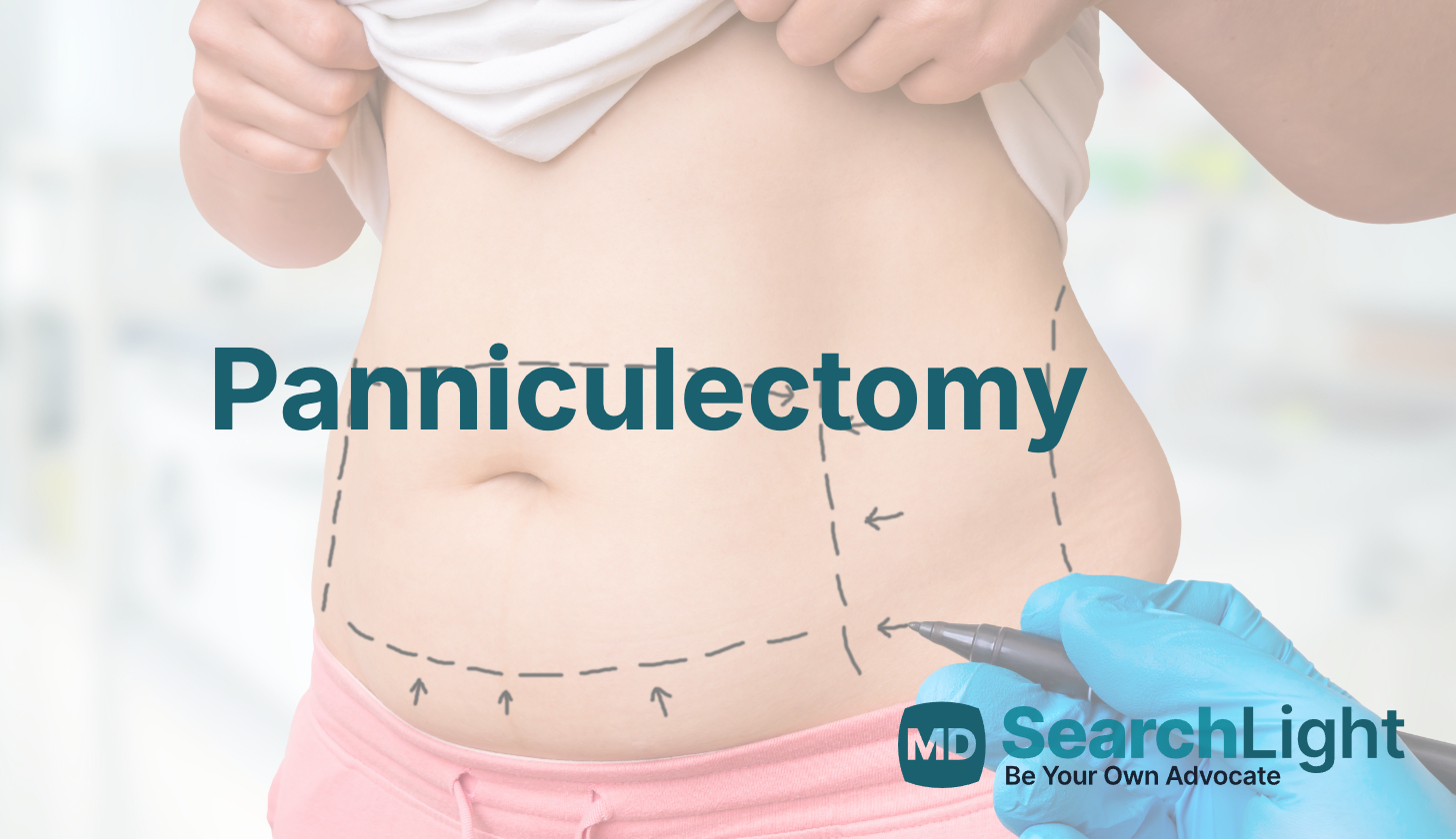 Panniculectomy - MD Searchlight