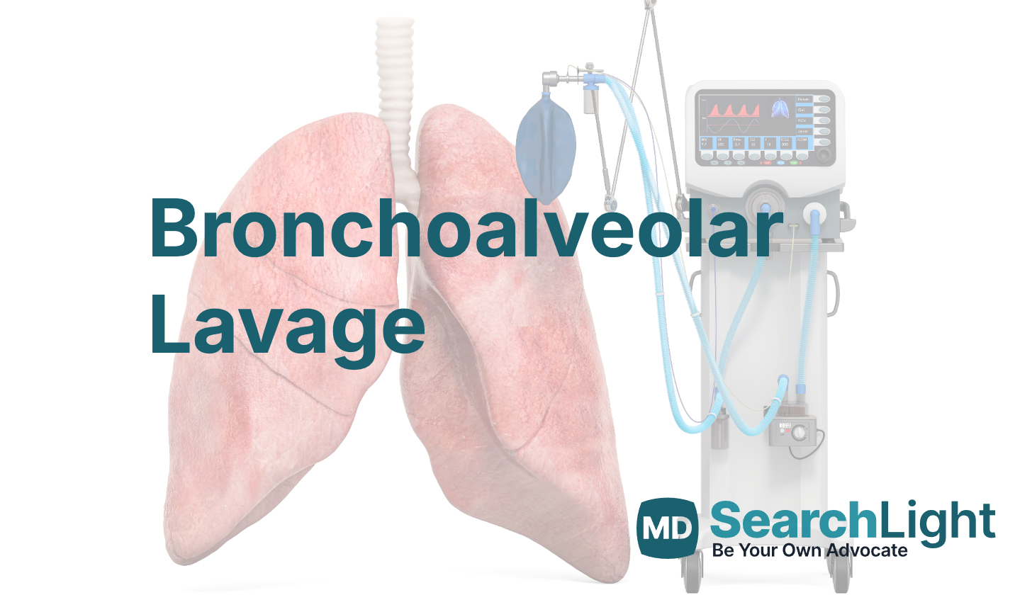 Bronchoalveolar Lavage (BAL) - MD Searchlight