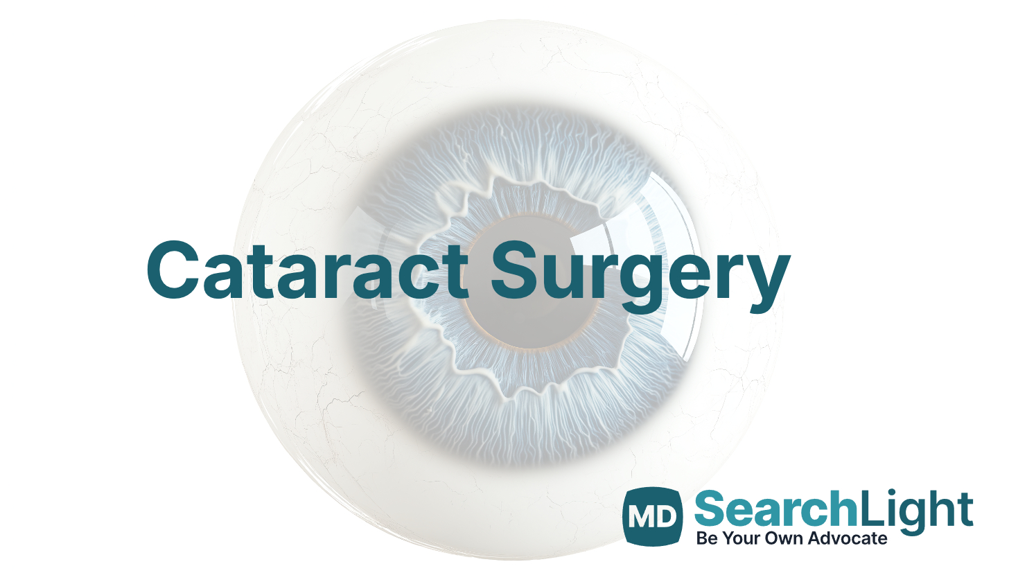 Cataract Surgery - MD Searchlight