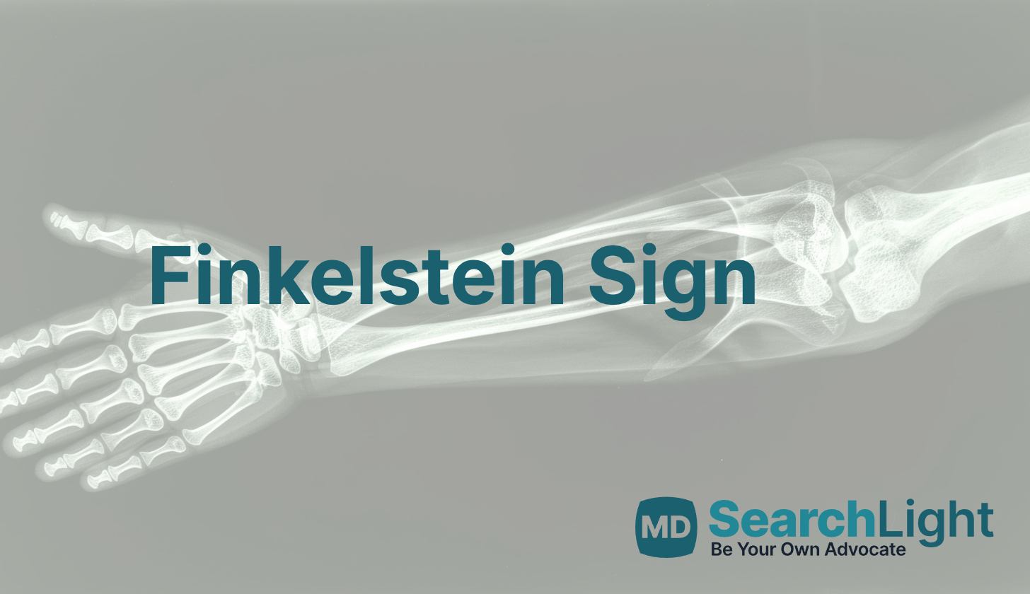 Finkelstein Sign (Finkelstein Test) - MD Searchlight