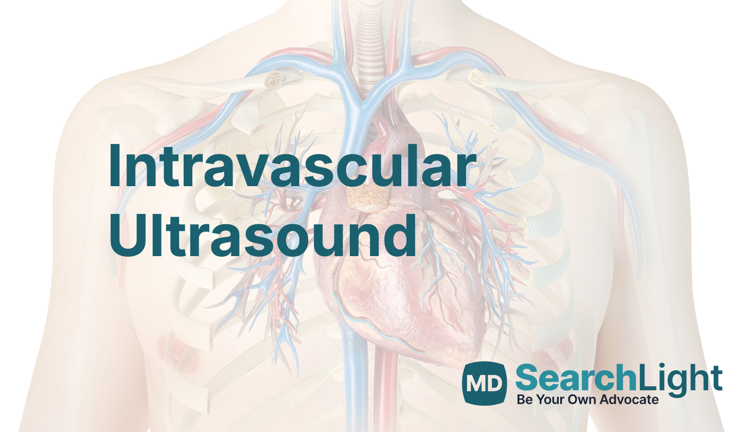 Intravascular Ultrasound (IVUS) - MD Searchlight