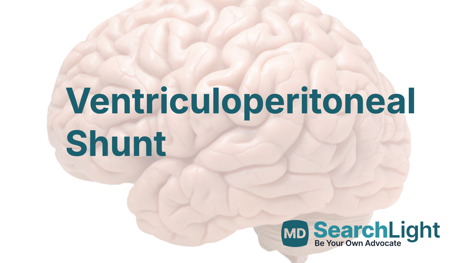 Ventriculoperitoneal Shunt - MD Searchlight