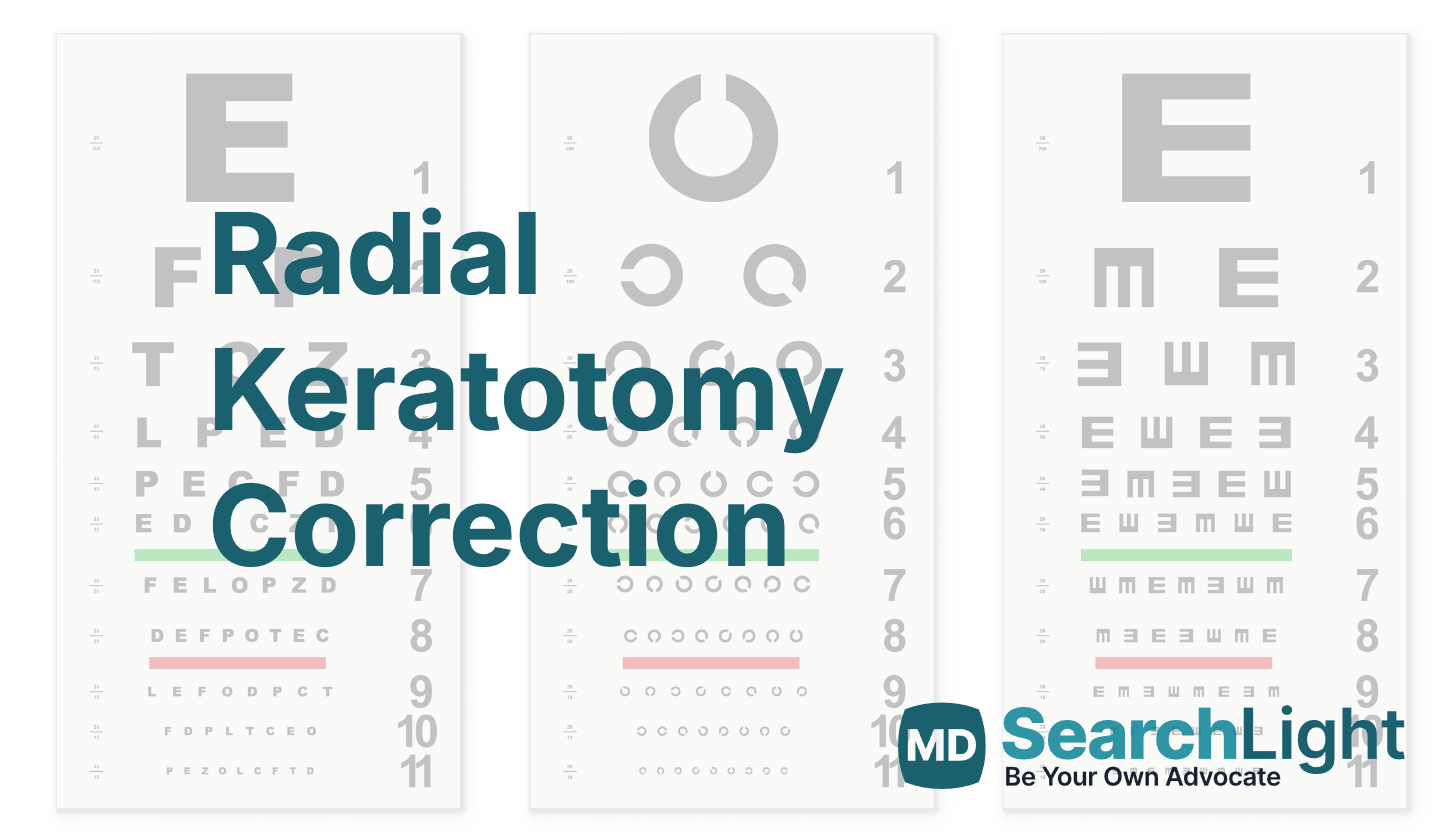 Radial Keratotomy Correction (Radial Keratotomy) - MD Searchlight