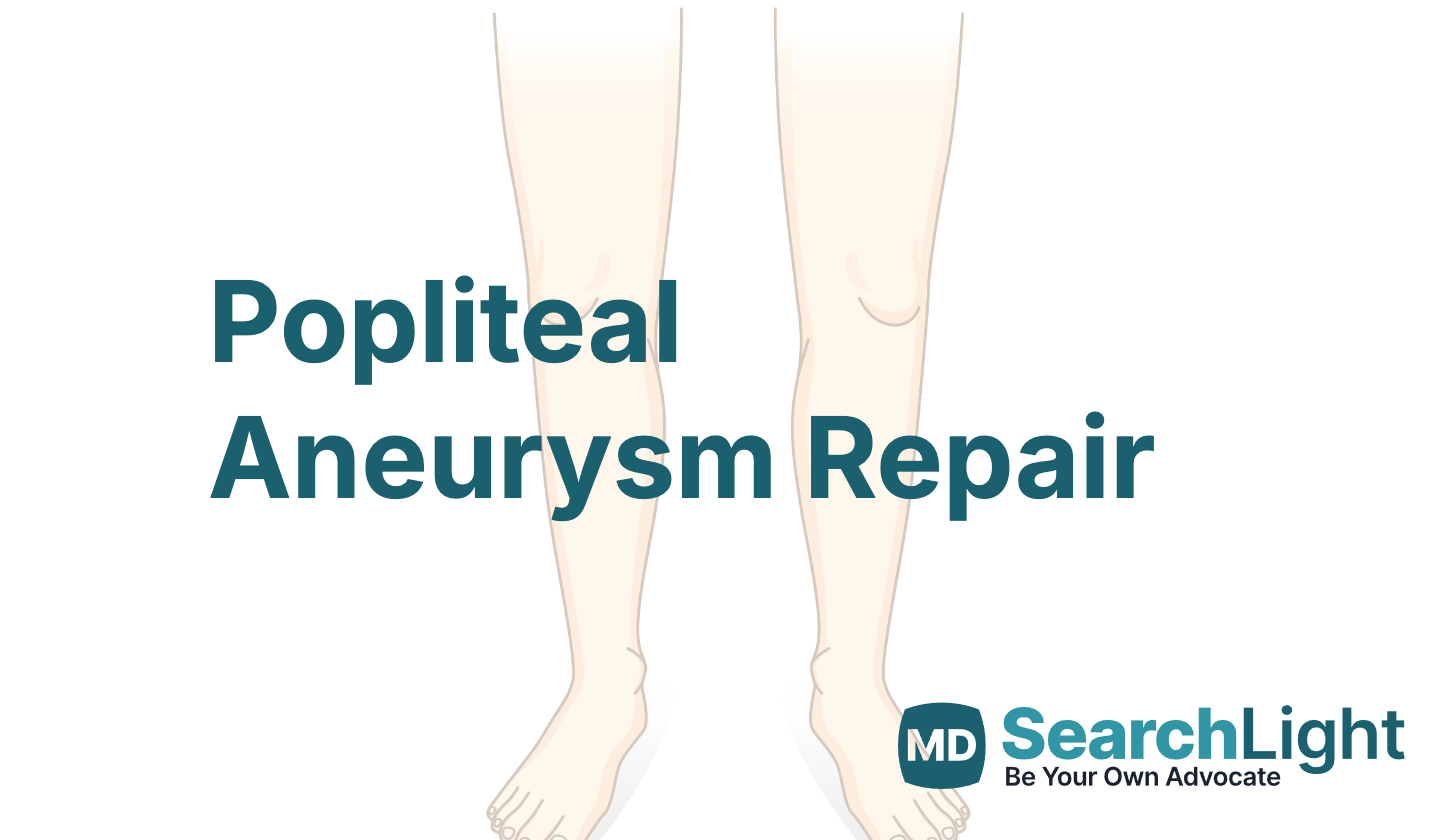 Popliteal Aneurysm Repair - MD Searchlight