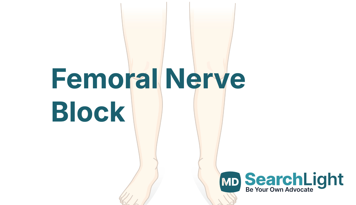 Femoral Nerve Block (Nerve Block) - MD Searchlight