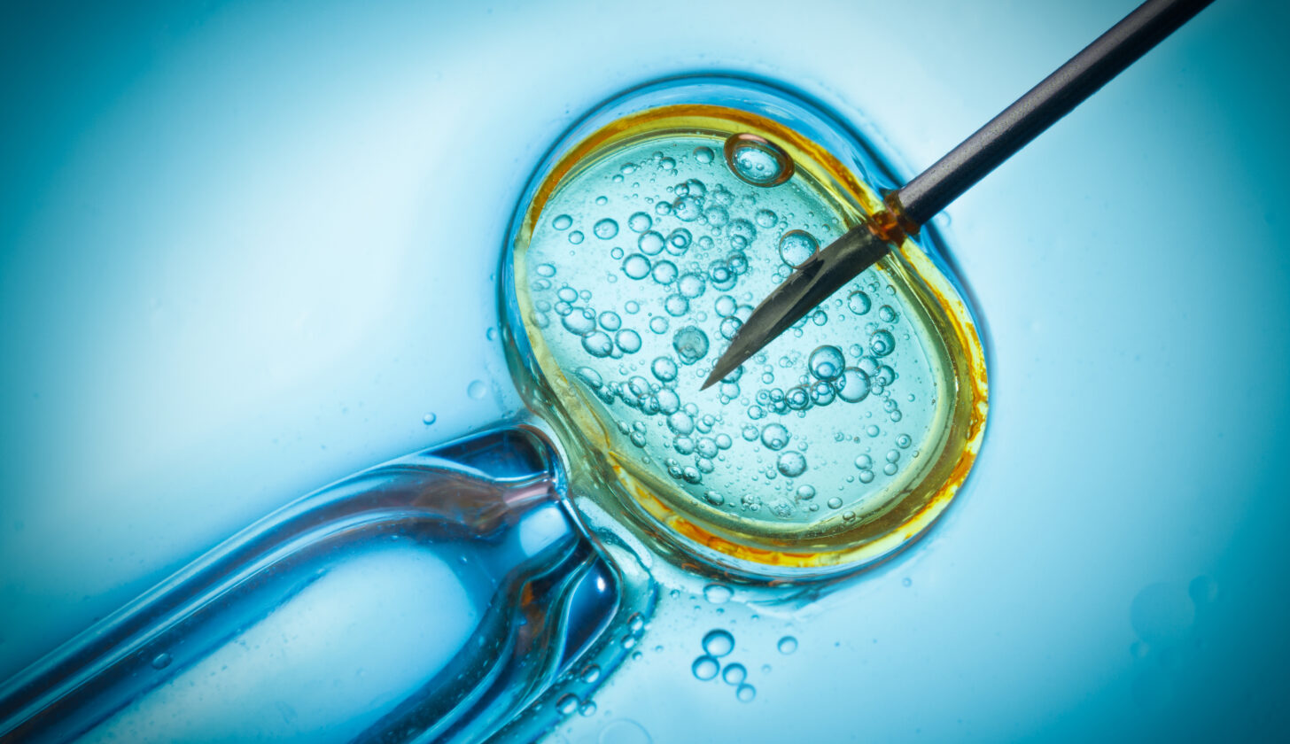 IVM: Understanding the Differences of IVM and IVF - MD Searchlight