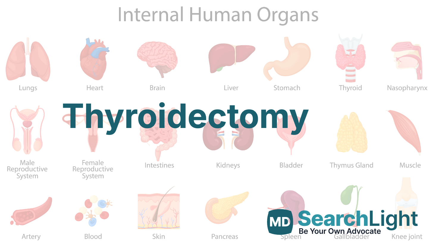 Thyroidectomy (Thyroid Surgery) - MD Searchlight