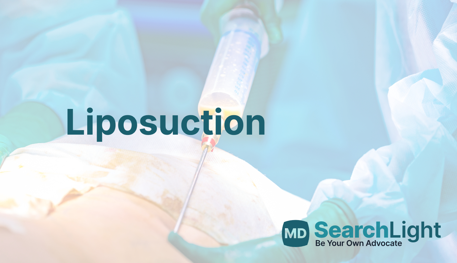 Liposuction - MD Searchlight