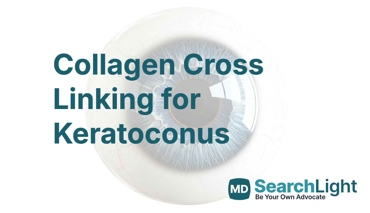Collagen Cross Linking for Keratoconus (Corneal Cross Linking) - MD ...