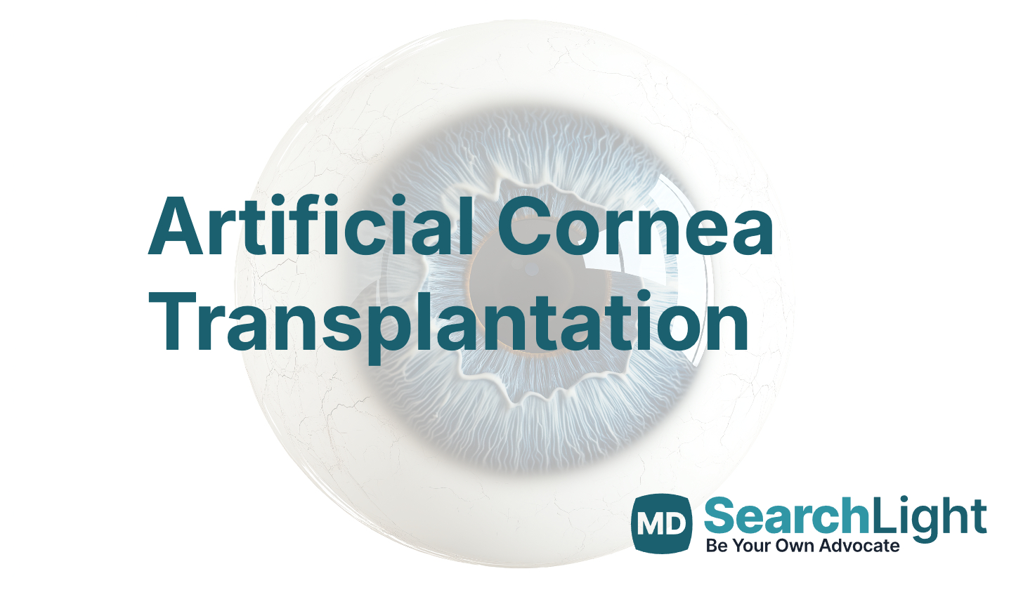 Artificial Cornea Transplantation (Keratoprosthesis) - MD Searchlight