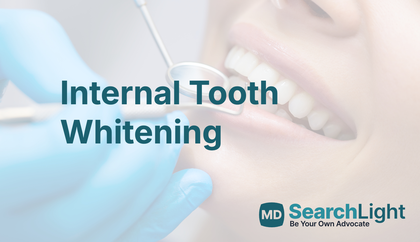 Internal Tooth Whitening (Tooth Whitening) - MD Searchlight
