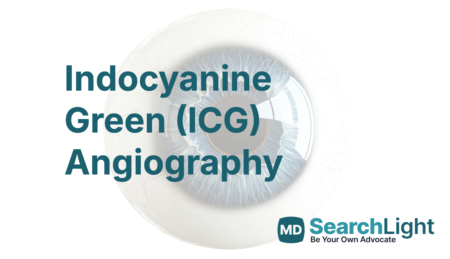 Indocyanine Green (ICG) Angiography (ICG Angiography) - MD Searchlight