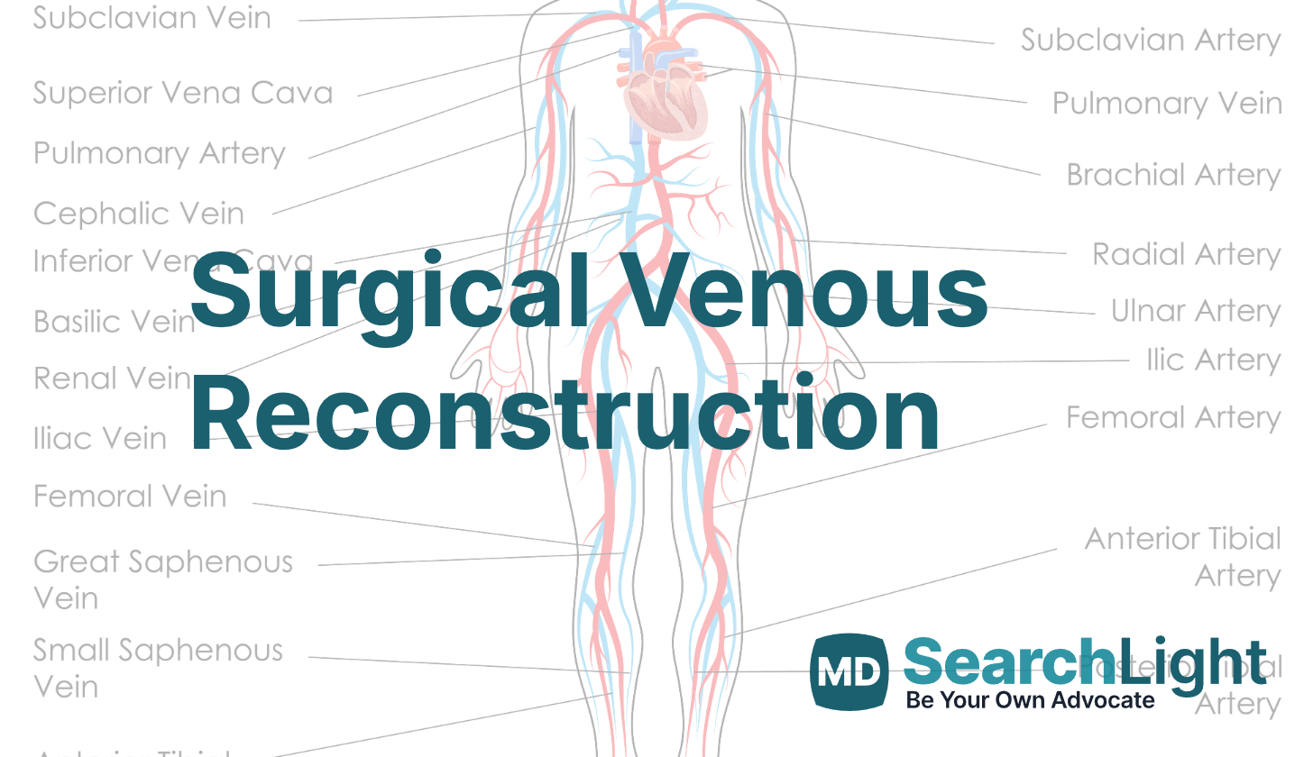 Surgical Venous Reconstruction - MD Searchlight