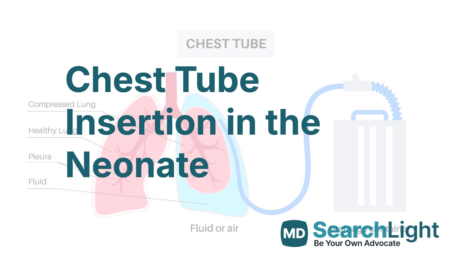 Chest Tube Insertion in the Neonate (Neonatal Chest Tube) - MD Searchlight