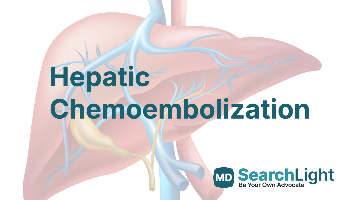 Hepatic Chemoembolization (Transarterial Chemoembolization (TACE)) - MD ...