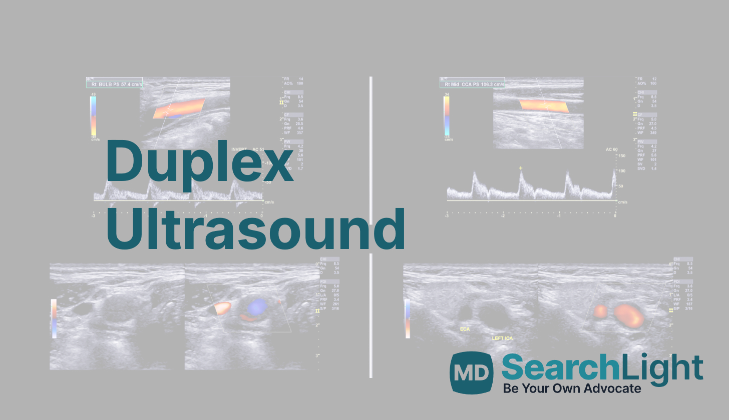 Duplex Ultrasound (Ultrasound) - MD Searchlight