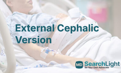 External Cephalic Version (ECV) - MD Searchlight