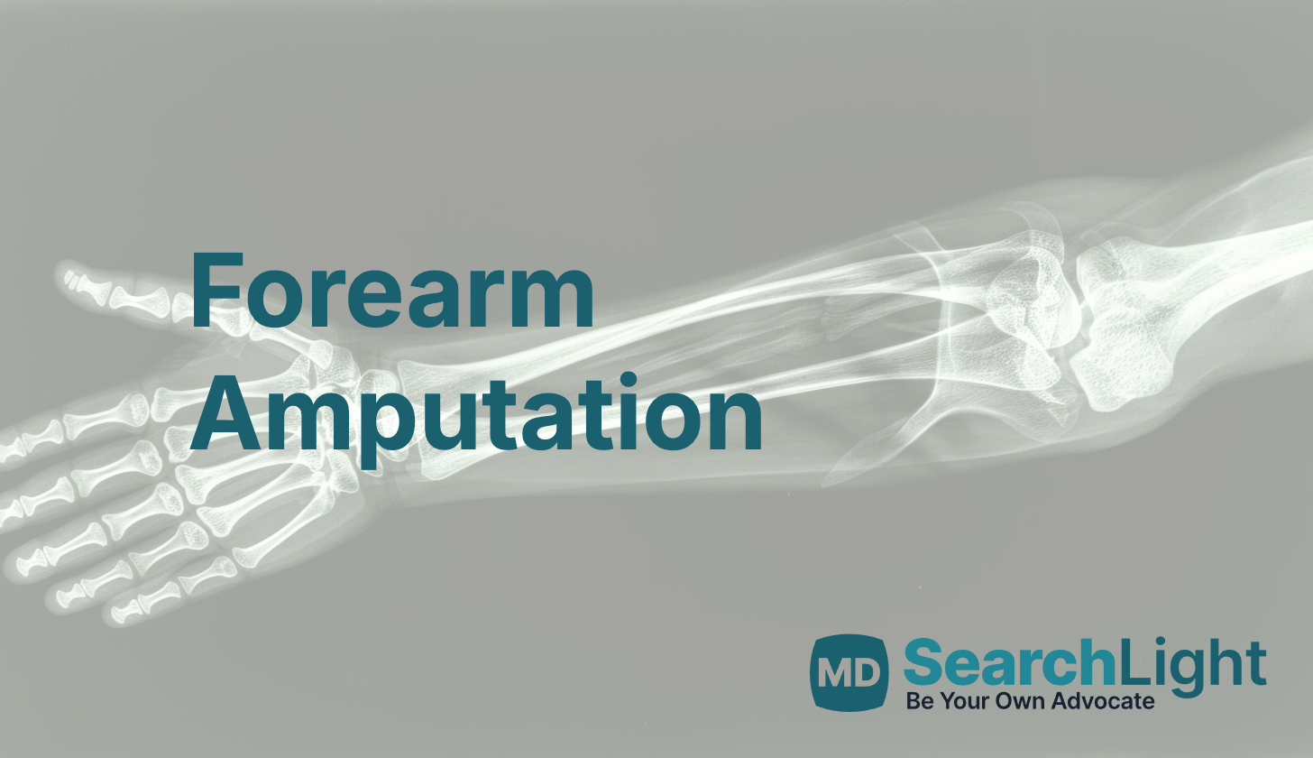 Forearm Amputation (Amputation) - MD Searchlight
