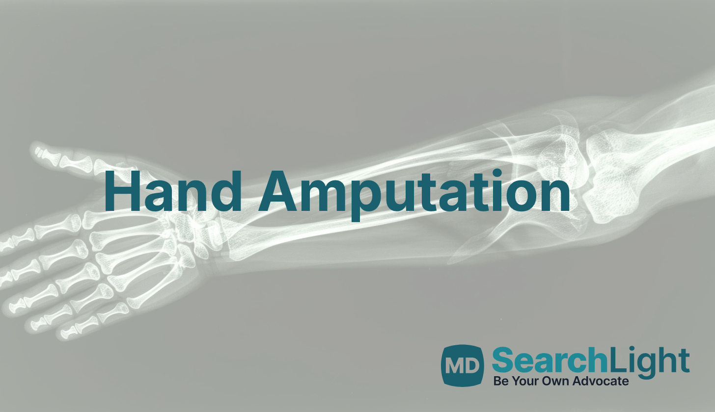 Hand Amputation (Amputation) - MD Searchlight