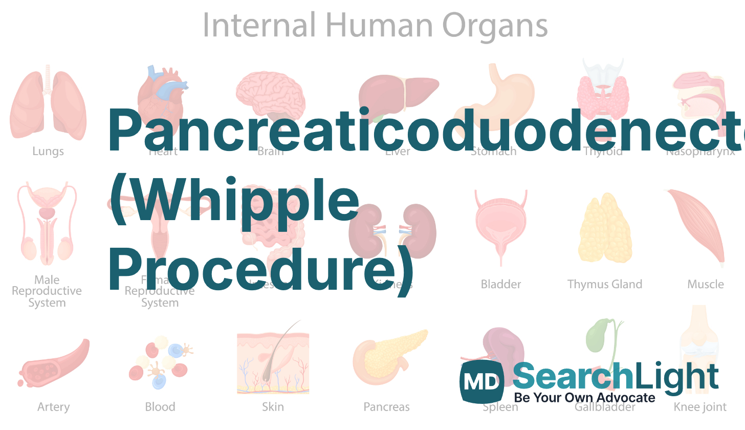 Pancreaticoduodenectomy (Whipple Procedure) (Whipple Procedure) - MD ...