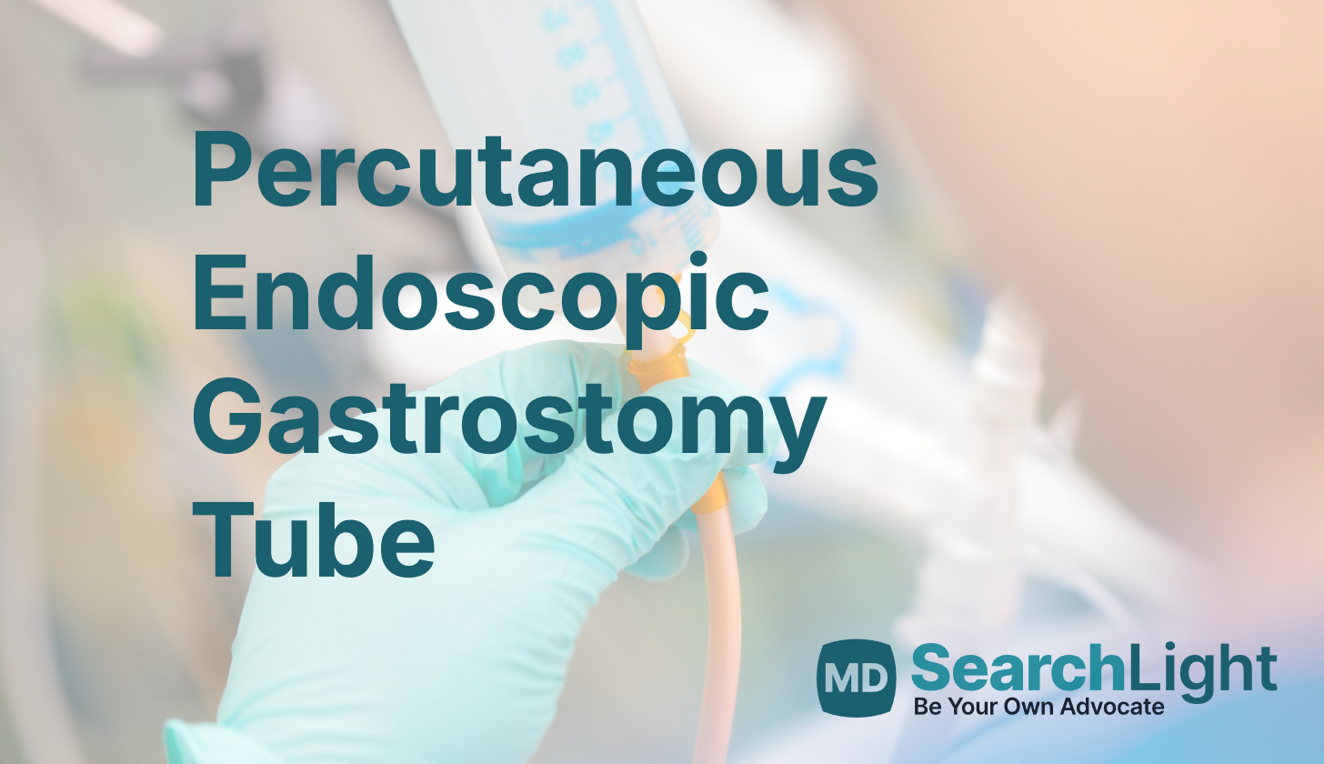 Percutaneous Endoscopic Gastrostomy Tube (PEG Tube) - MD Searchlight