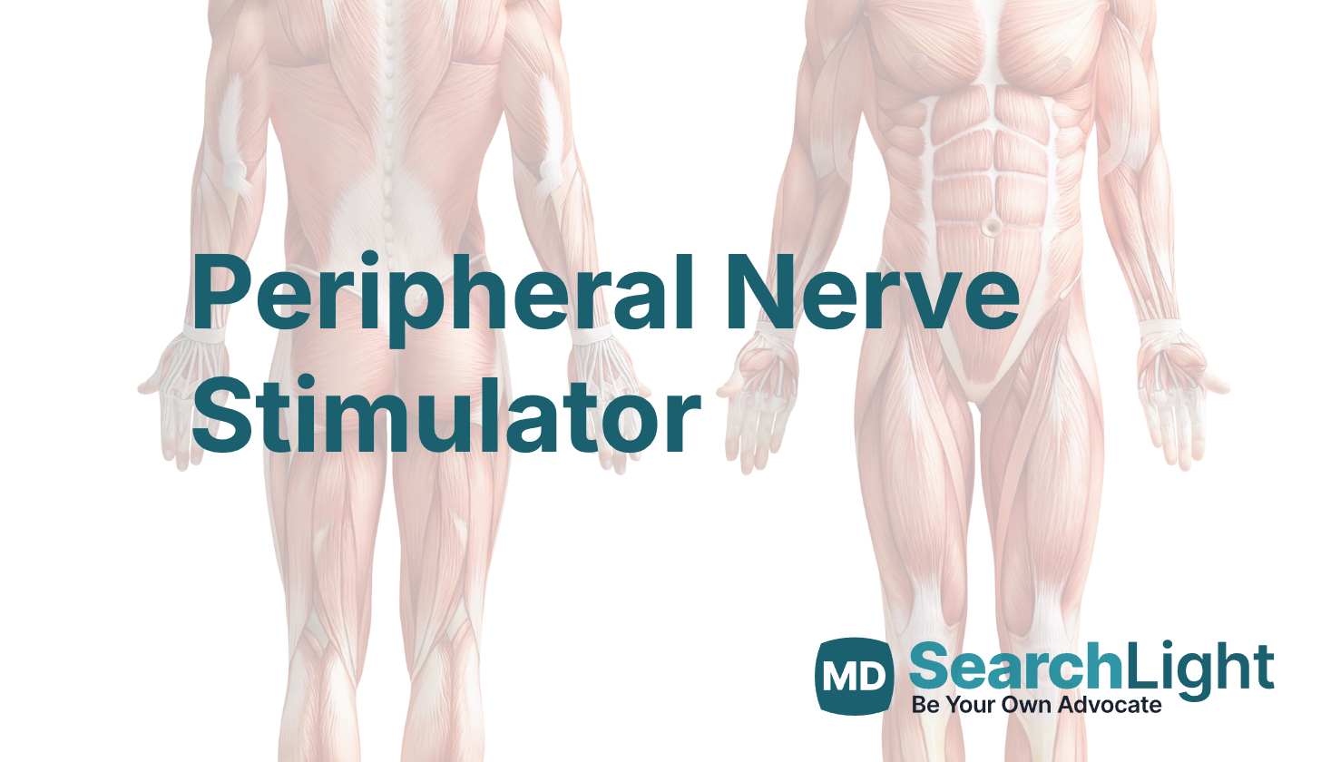 Peripheral Nerve Stimulator (Peripheral Nerve Stimulation) - MD Searchlight