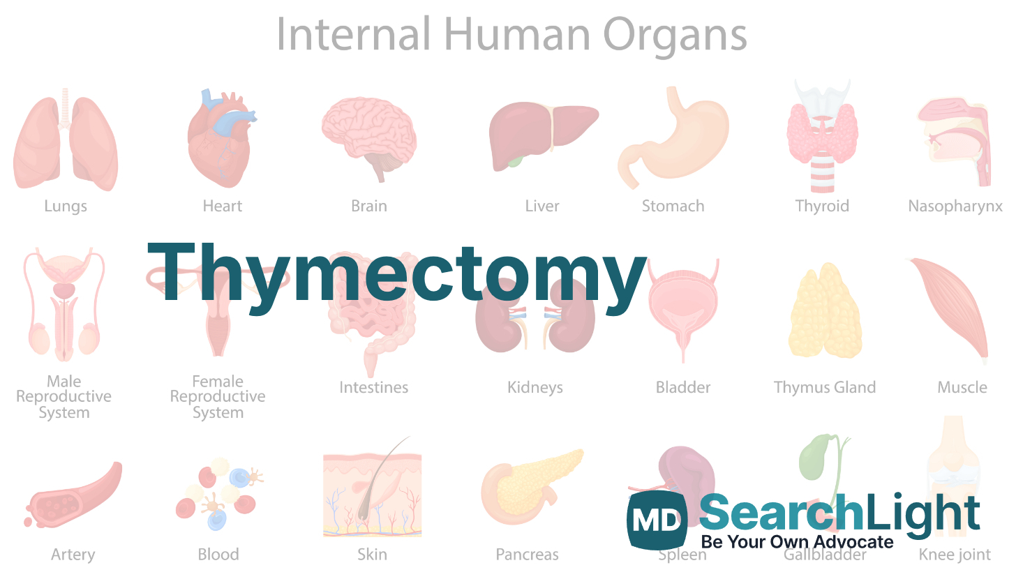 Thymectomy - MD Searchlight