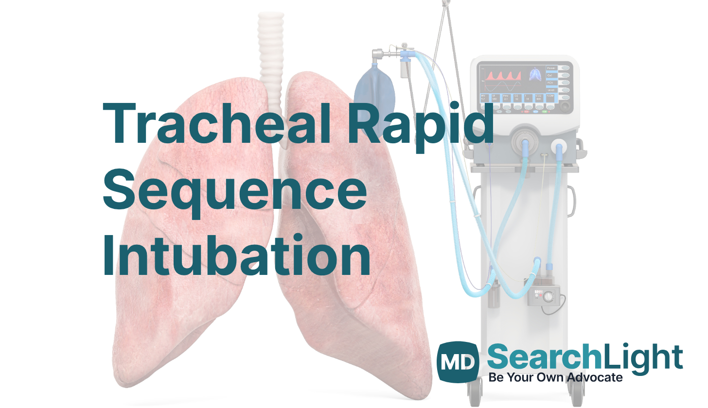 Tracheal Rapid Sequence Intubation (Rapid Sequence Intubation) - MD Searchlight