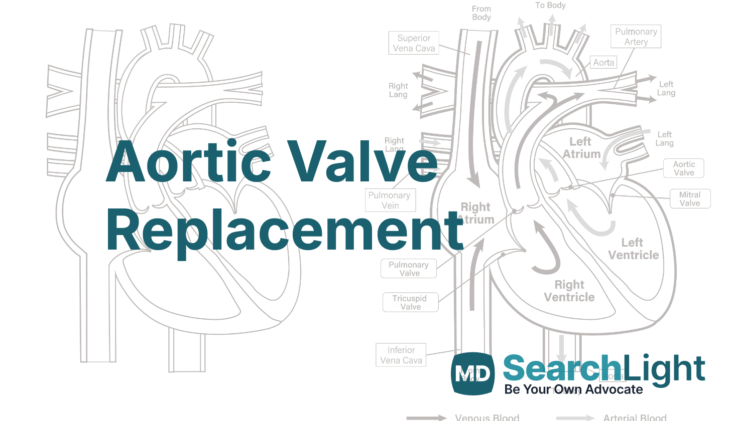 Aortic Valve Replacement (AVR) - MD Searchlight