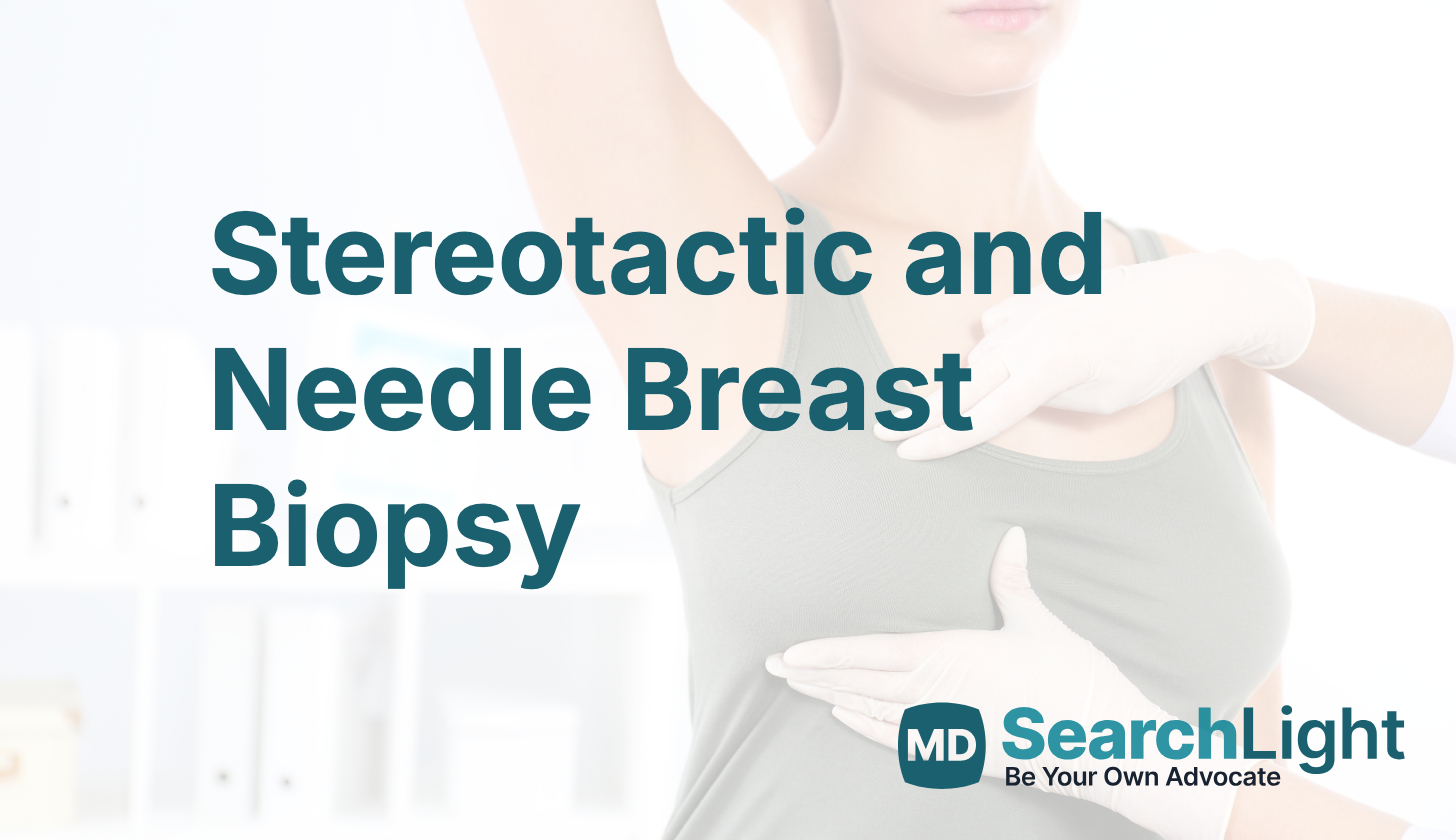 Stereotactic and Needle Breast Biopsy (Breast Biopsy) - MD Searchlight