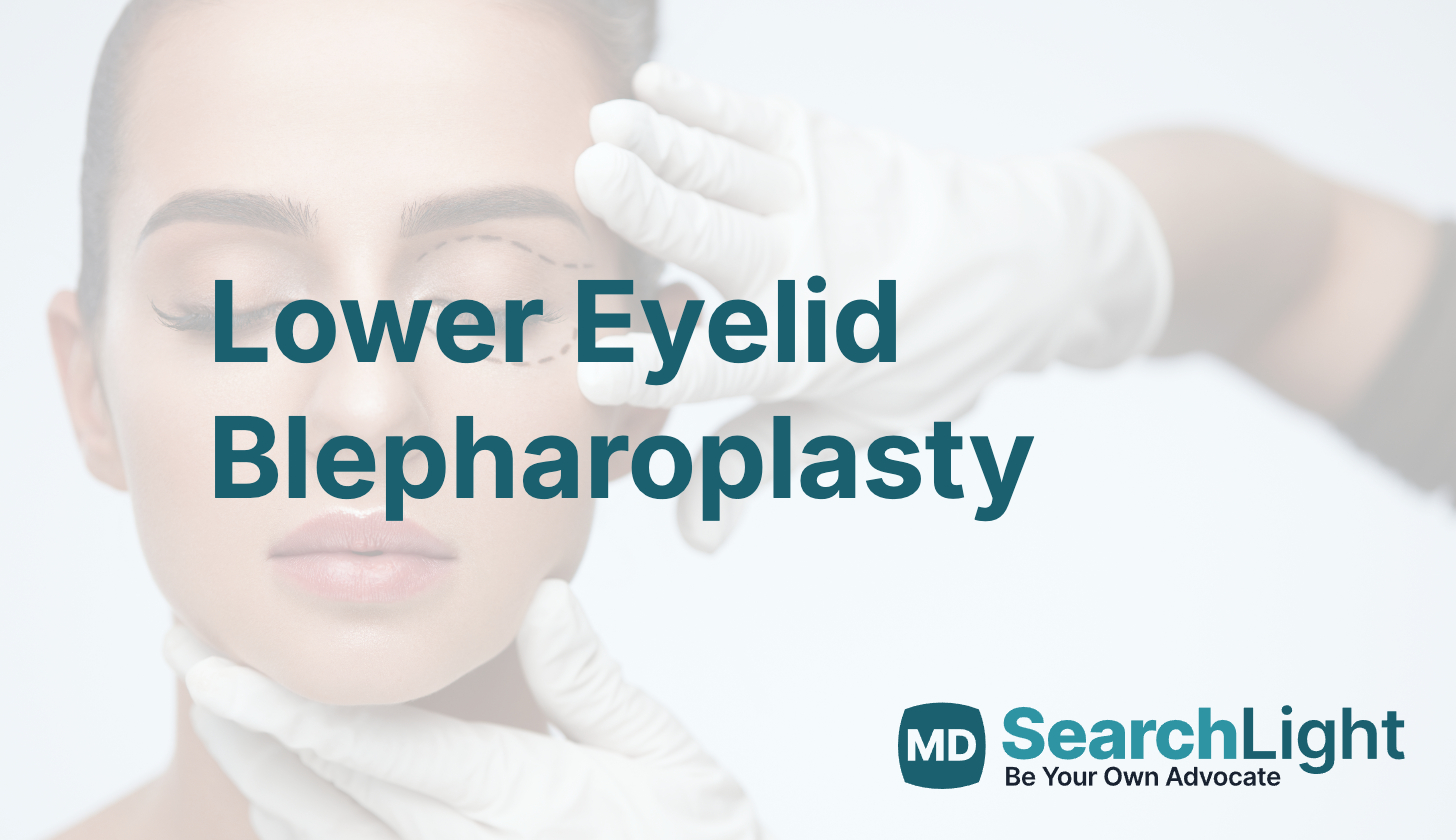 Lower Eyelid Blepharoplasty (Cosmetic Eyelid Surgery) - MD Searchlight