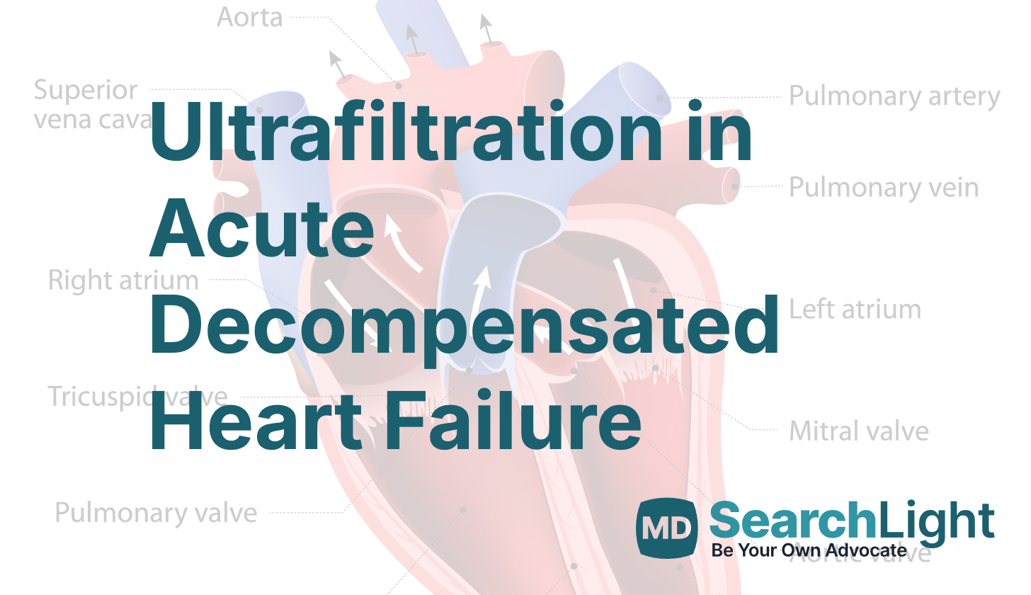 Ultrafiltration in Acute Decompensated Heart Failure (Ultrafiltration) - MD Searchlight