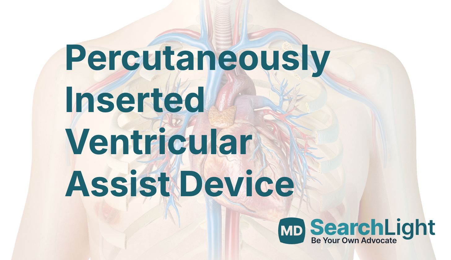 Percutaneously Inserted Ventricular Assist Device ( temporary heart ...
